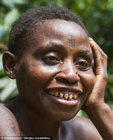 Most Extreme Body Modifications