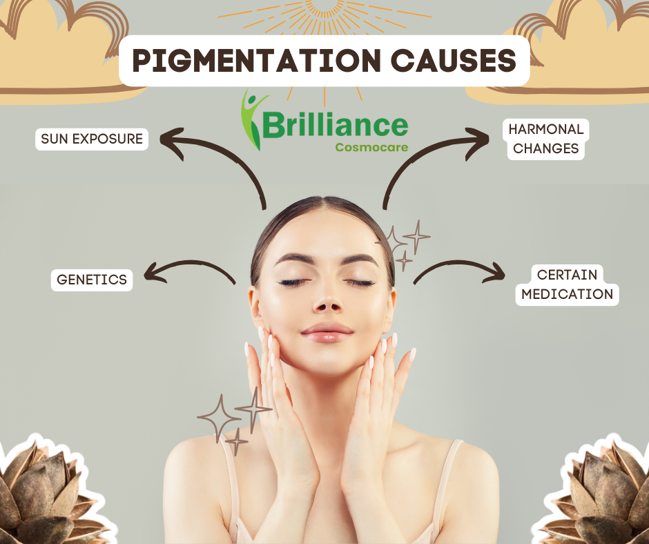 skinPigmentation Causes?. Introduction: Pigmentation, though a… | by ...