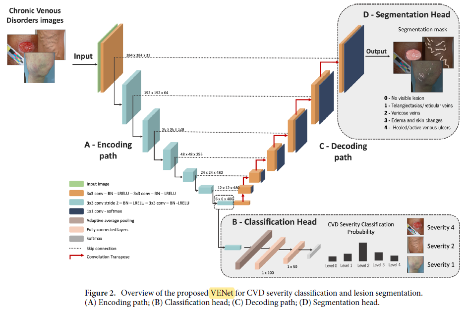 Review — A Multi‑task Convolutional Neural Network For Classification And Segmentation Of