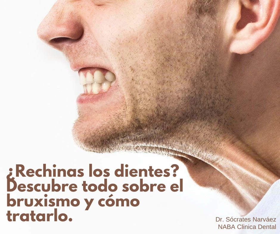 ¿Rechinas los dientes? Descubre todo sobre el bruxismo y cómo tratarlo ...