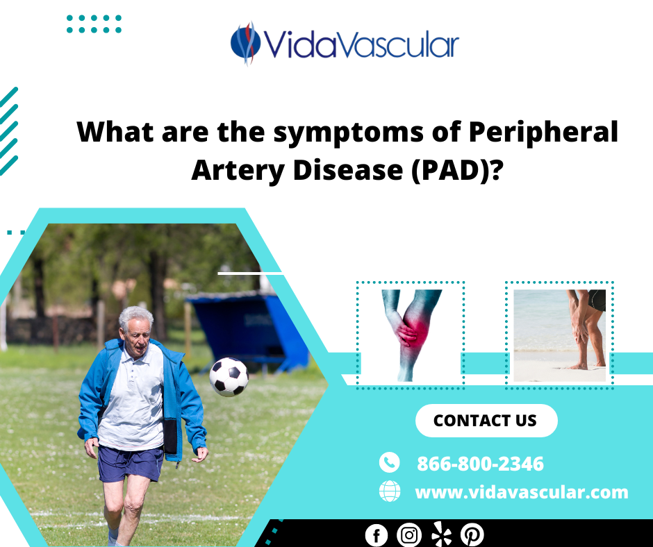 What are the symptoms of Peripheral Artery Disease (PAD)? | by Vida ...
