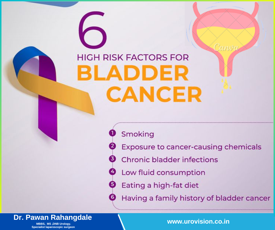 6 High-Risk Factors for Bladder Cancer You Should Know | by ...
