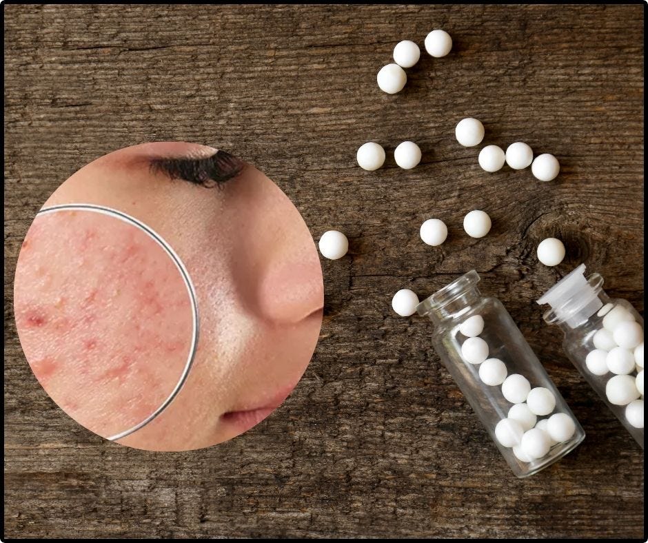 Understanding the Intersection of Skin Issues and Arthritis Management ...