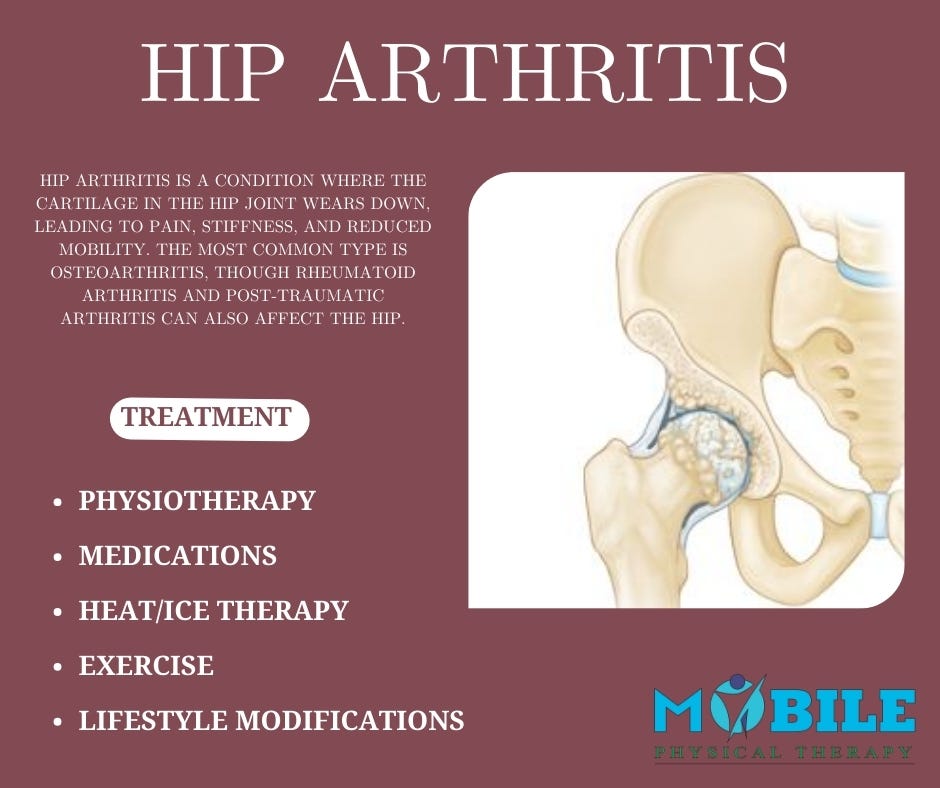 Understanding Hip Arthritis: A Step-by-Step Guide to Symptoms, Causes ...