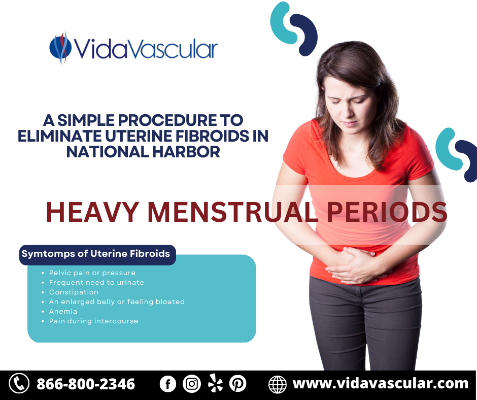 A simple procedure to eliminate uterine fibroids in National Harbor ...
