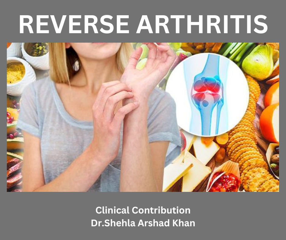 Rheumatoid Arthritis, how to win this battle. | by Dr. Shehla Arshad Khan | Dec, 2023 | Medium