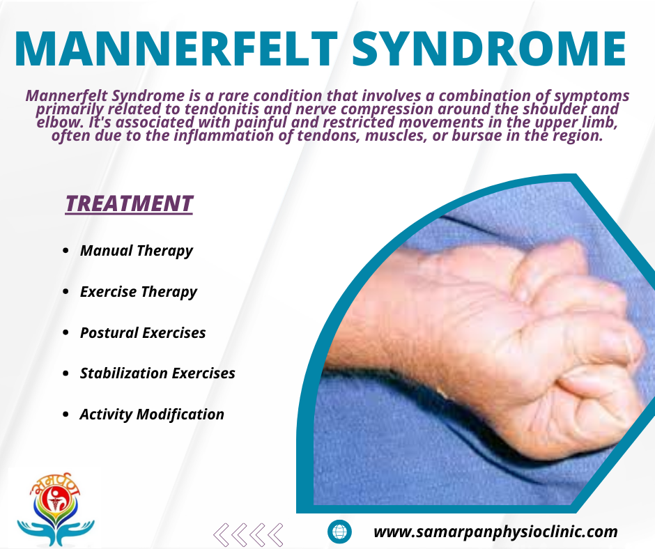 Mannerfelt Syndrome: A Rare and Serious Complication of Rheumatoid ...