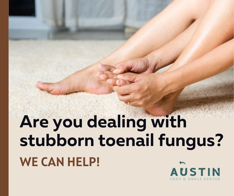 Toenail fungus is a common infection on the nail, and it can be ...