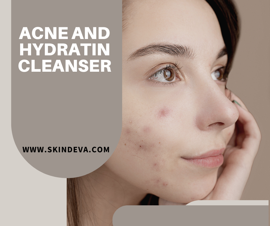Acne and hydratin cleanser. Do you want to get rid of acne on your ...