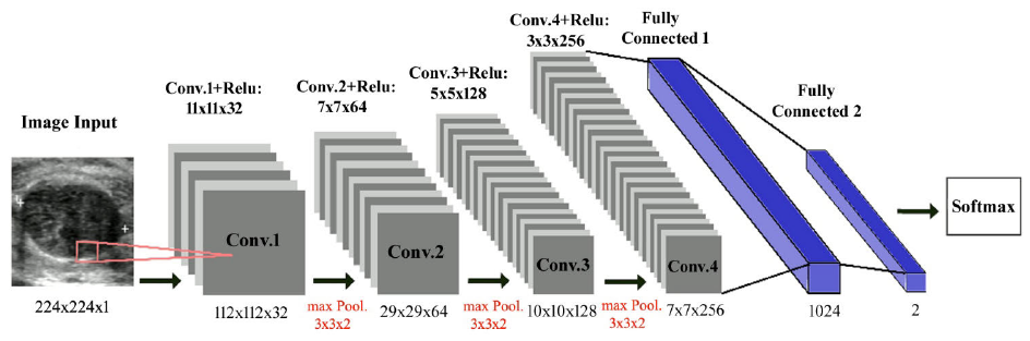 Review — Breast Lesion Classification in Ultrasound Images Using Deep ...