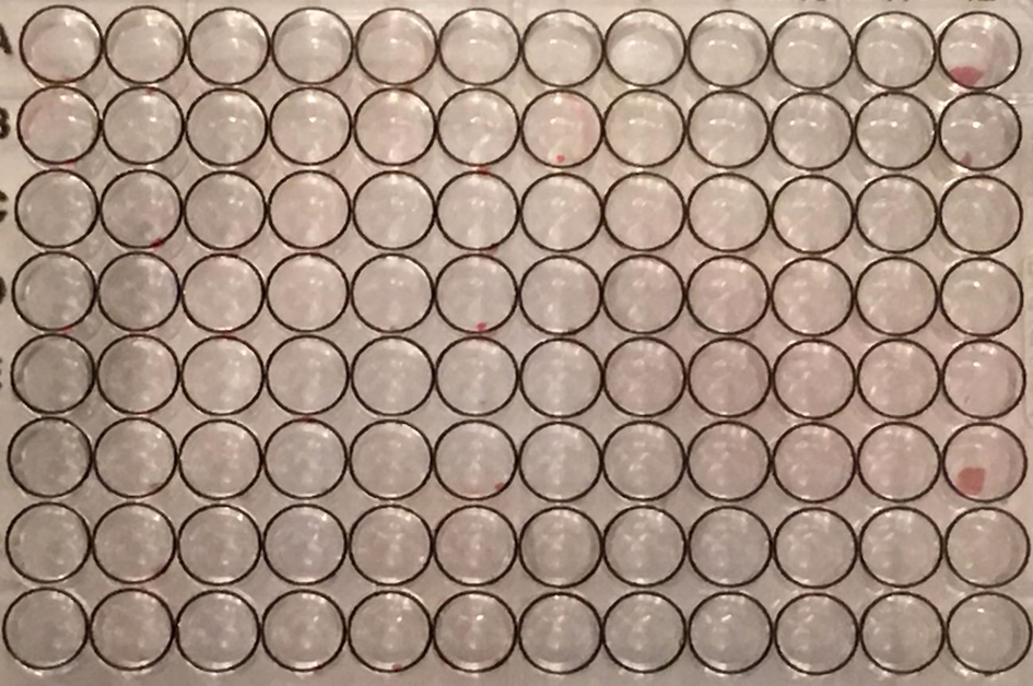 Hough Circle Transform Parameter Tuning with Examples | by Işınsu | Medium