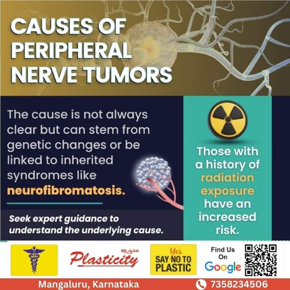 The exact causes of peripheral nerve tumors is not clear, but some are ...