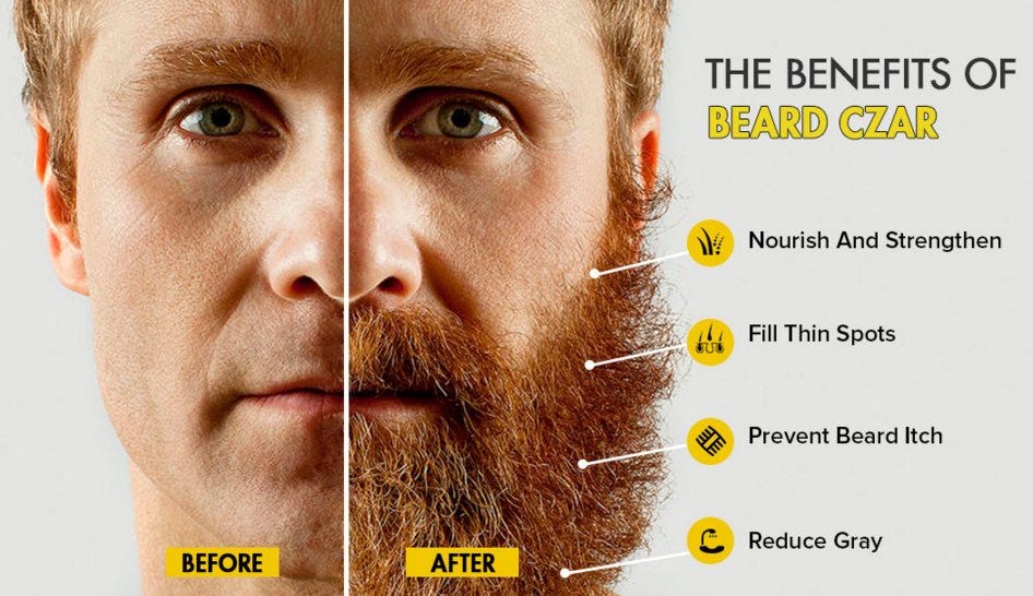 Patchy Facial Hair Men