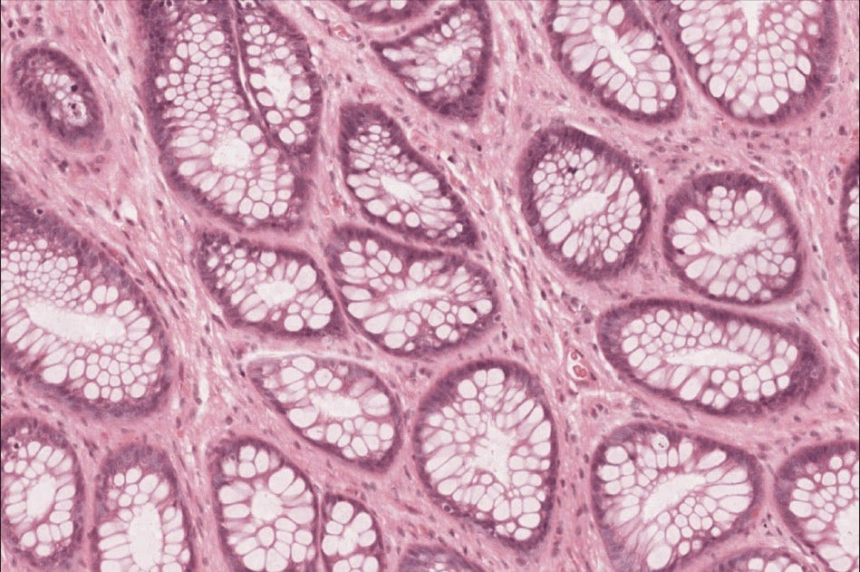 Revolutionizing Medical Research with Advanced Digital Pathology Image ...