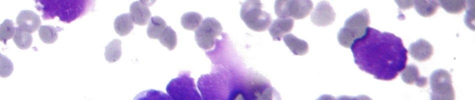 Breast Cancer Dataset Classification Using KNN Algorithm | by Yana ...