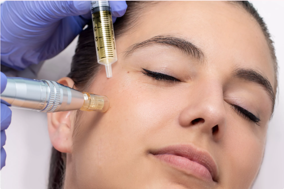 What is Microneedling: Types, Cost, and FAQs | by Jamesjung | DrSkin ...
