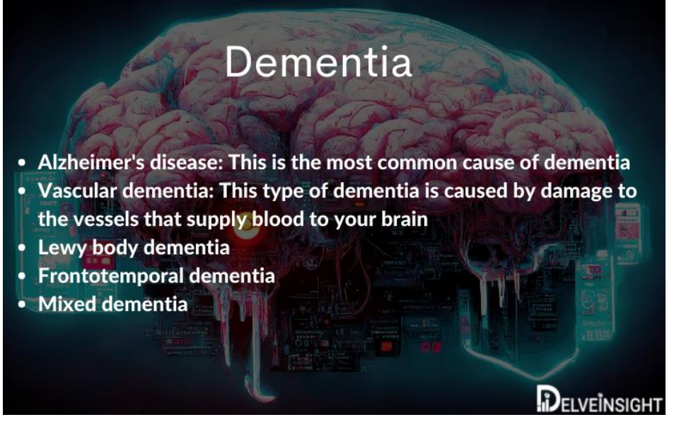 Management of Dementia with the help of new innovations and ...