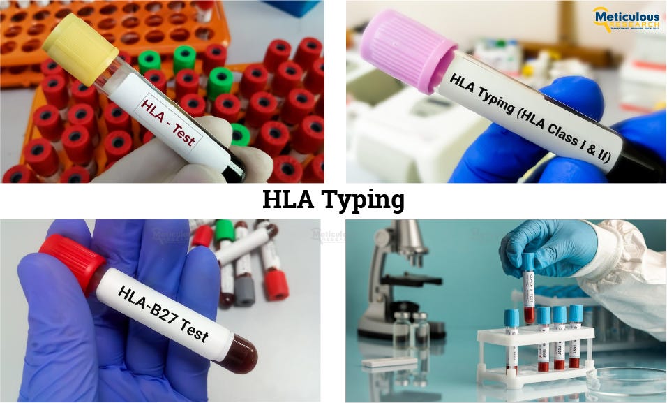 HLA Typing Market Projected to Reach $1.9 Billion by 2029 | by Pallavi ...
