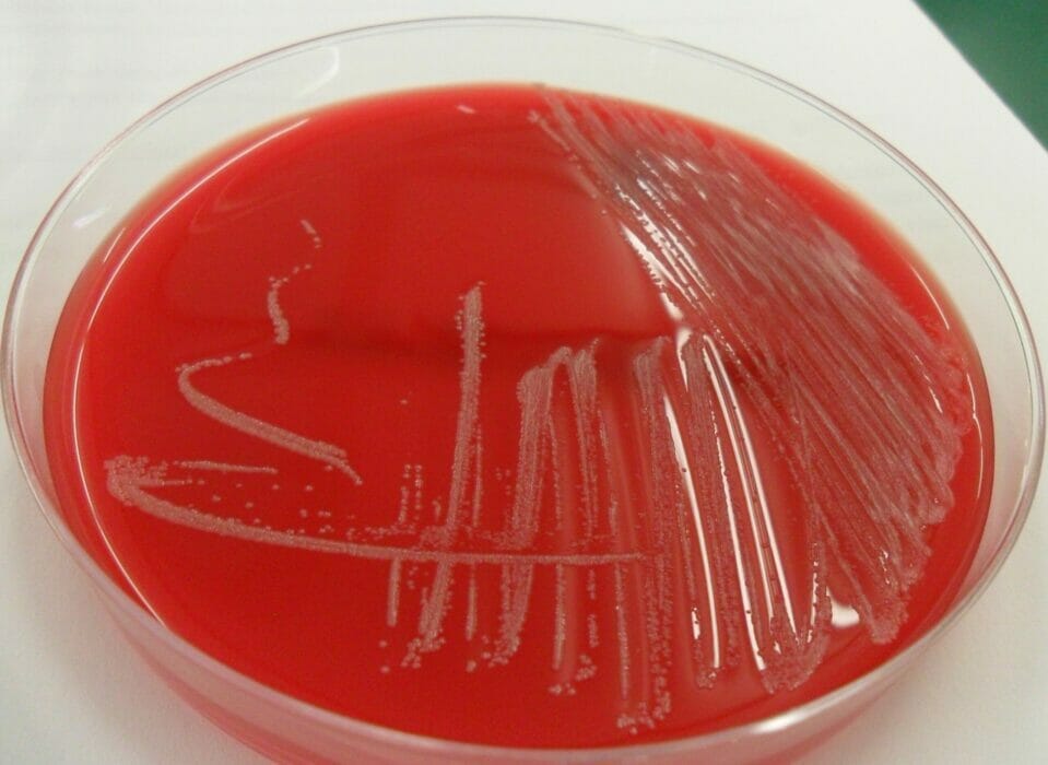 Understanding Capnocytophaga Symptoms | by Symptom Finder | Jun, 2023 ...