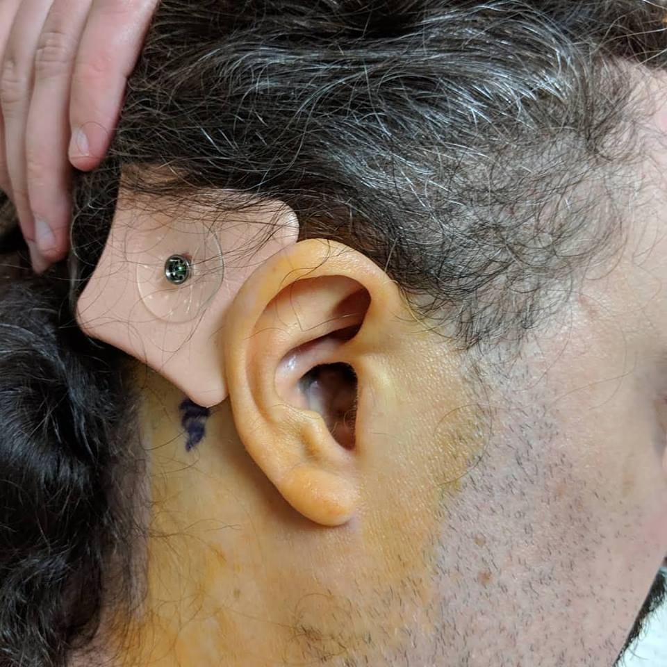 Disability and Cyberpunk. Earlier this week I got a hole in my… | by ...