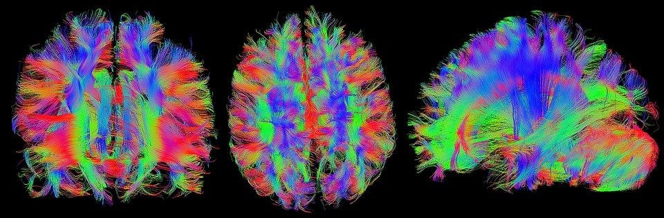 How Life Flashes in the Brain During the Final Moments Before Death ...