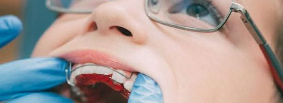 Early Orthodontic Treatment. Interceptive orthodontics is the… | by ...