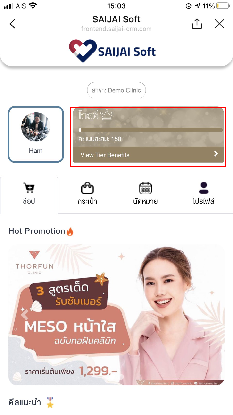 สิทธิประโยชน์ที่ไม่ควรพลาดสำหรับลูกค้าคลินิกความงาม - SAIJAI CRM - Medium