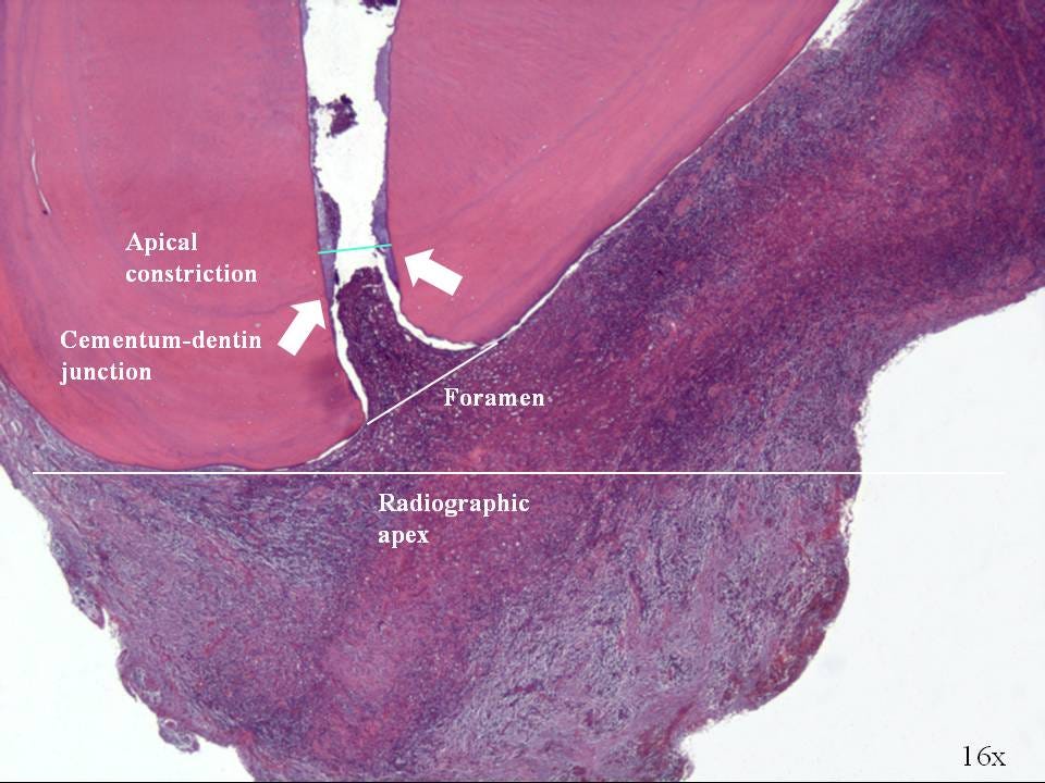 Apical Foramen Histology