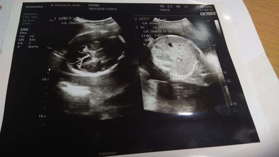 Rekomendasi USG dan Dokter SpOG di Solo | by Diana Nurwidiastuti | Medium