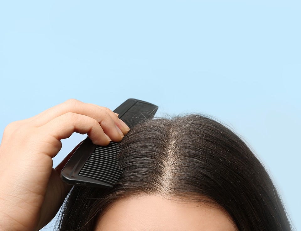 Understanding Scalp Types: Choosing the Perfect Products for Healthy ...