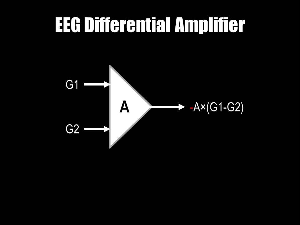 A Primer On EEG Reading. Why this Primer ? | by Kaspar A. Schindler ...