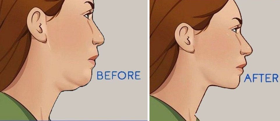 How To Lose Weight In Your Neck Safely | by Easy Fat Loss Solutions ...