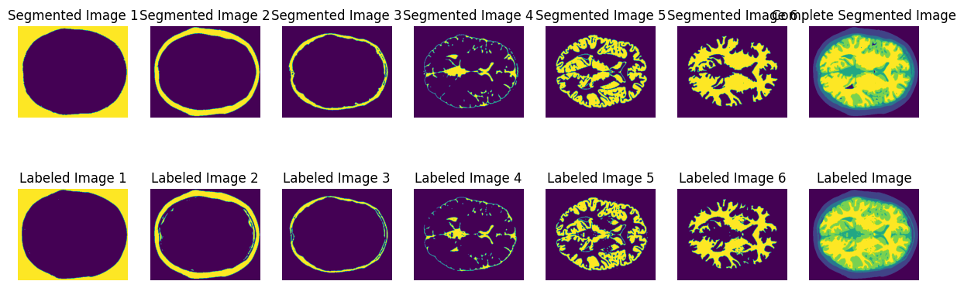 Brain Tissue Segmentation using Computer Vision | by Durgesh Nandan ...