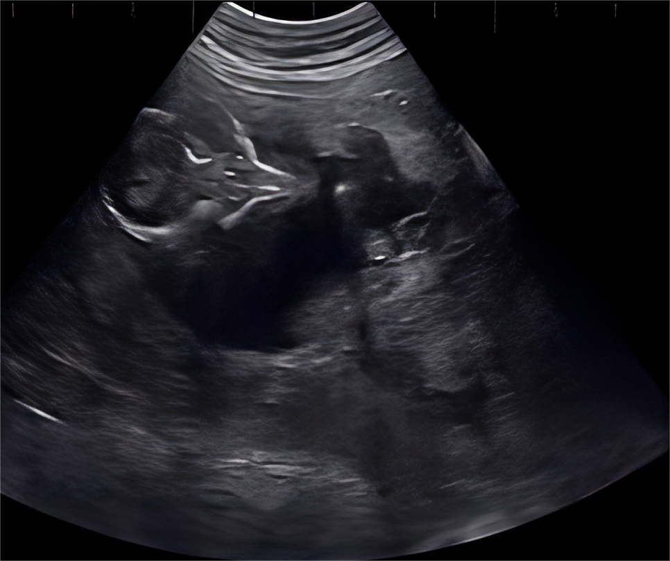 How does Veterinary Ultrasound Ultrasound work? | by Dwvet | Feb, 2024 ...
