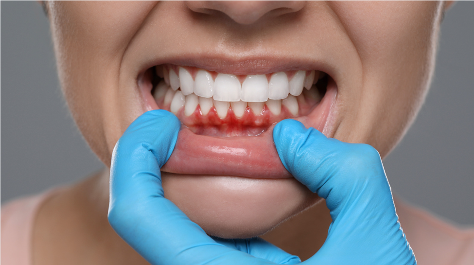 How Periodontists Work with General Dentists for Comprehensive Care ...