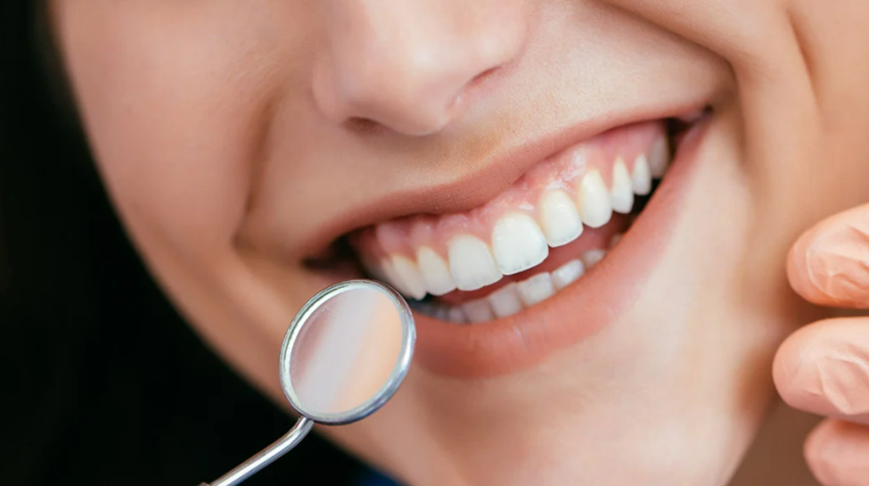 The Impact of Smile Makeovers on Personal and Professional Life | by Wesley W Lowe | May, 2025 ...