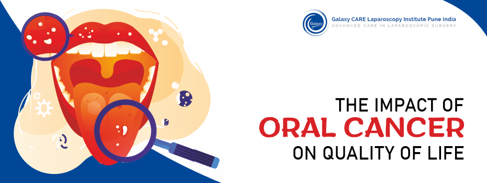 THE IMPACT OF ORAL CANCER ON QUALITY OF LIFE: SPEECH, EATING, AND ...