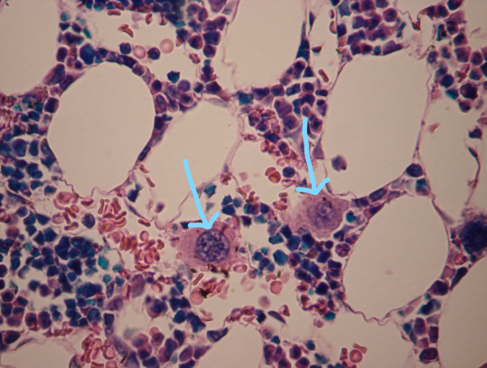 COVID-19 and Megakaryocyte Cells in the Brain | by Nancy Lovering ...