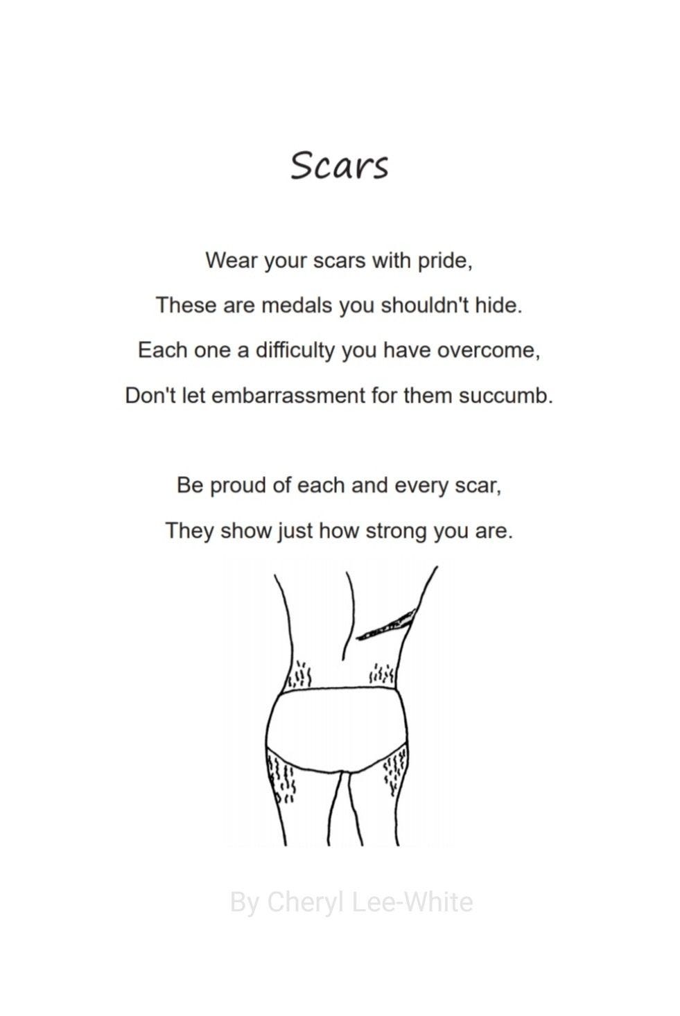 Scars. Scars are signs that you went through a… | by ...