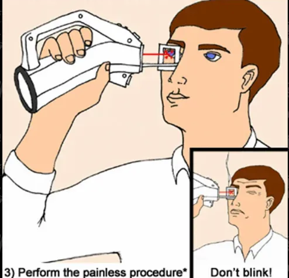 LASIK at Home. A website or commercial became a… | by Fabiyanes | Medium