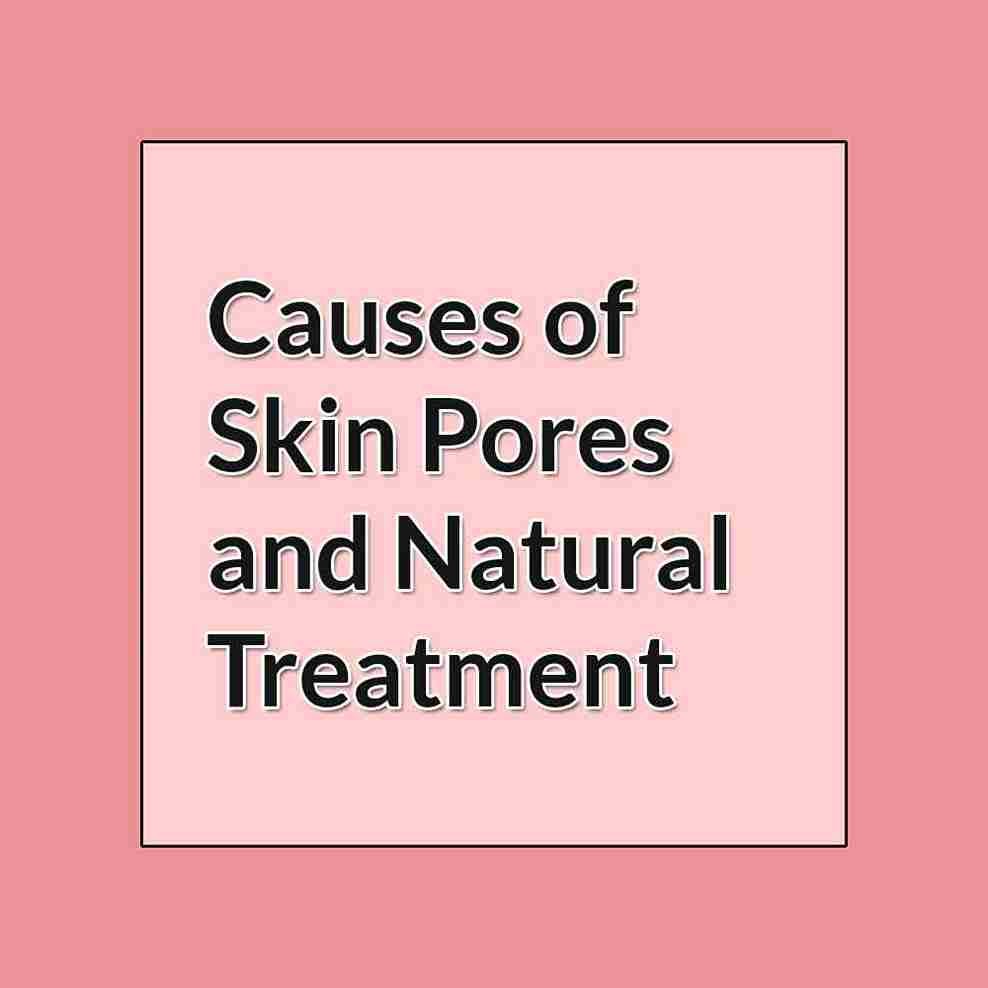 Causes of Skin Pores and Natural Treatment | by Bilawal | Medium