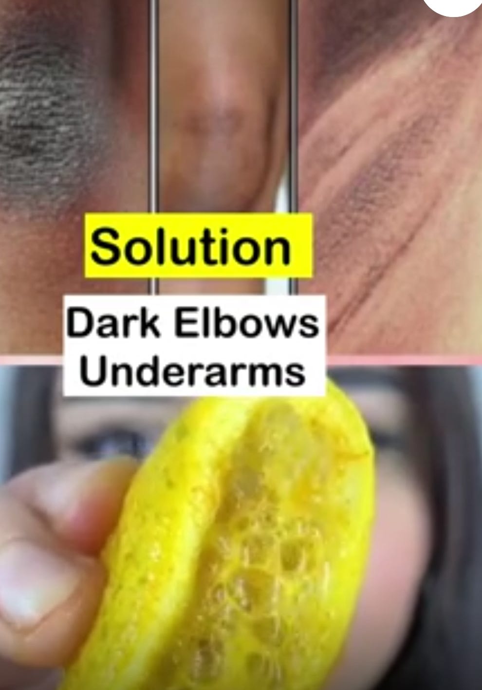 Dark underarms solution | by Esho Esho | Oct, 2024 | Medium
