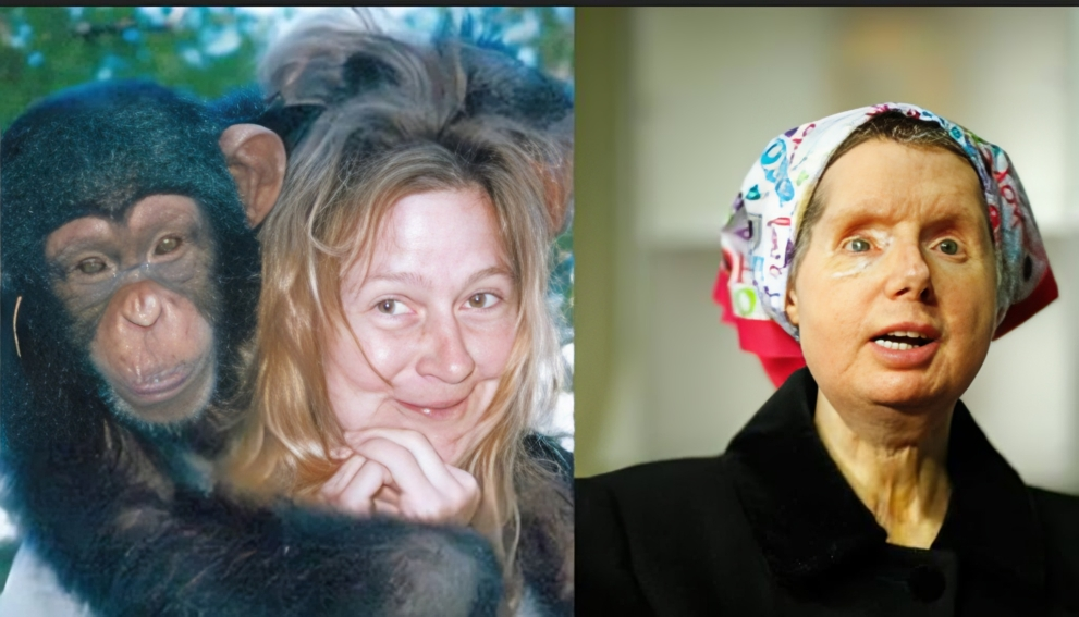 Charla Nash and Her Survival Of Gory Chimp attack | by C.S Blackwood ...
