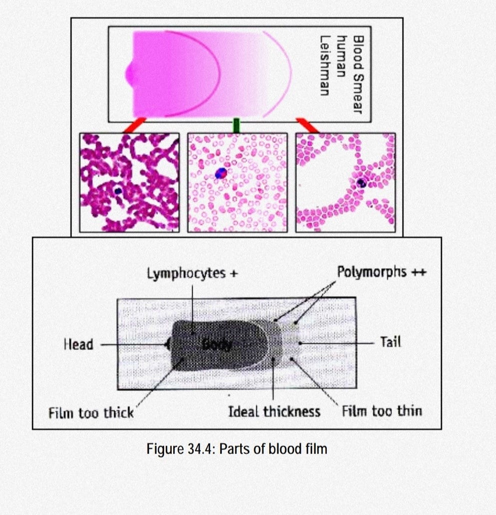 PREPARATION OF BLOOD FILM. Blood films can be made on cover slips… | by ...