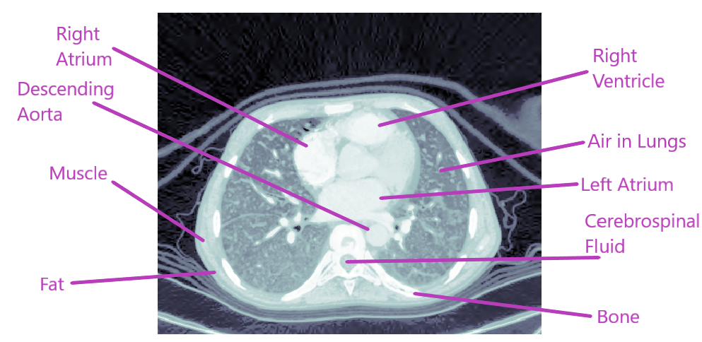 A Matter of Grayscale: Understanding Dicom Windows | by Amrit Virdee ...