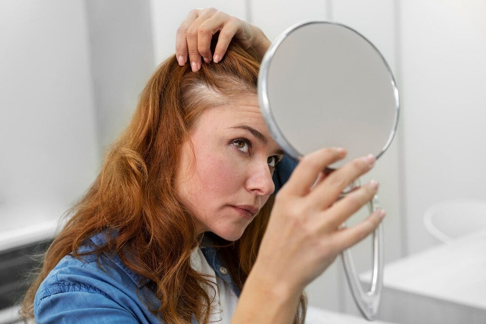 Hormones and Hair Thinning: Everything You NEED to Know | by Chloe Holt ...