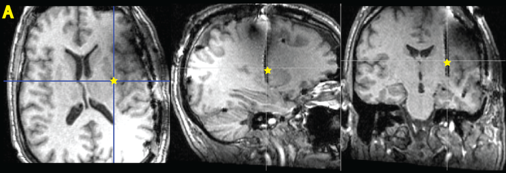The Neural Networks Underlying The Illusion Of Time Dilation By Rafeed Medium