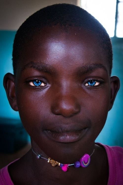 African Americans With Blue Eyes