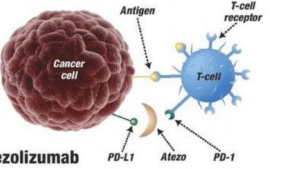 Atezolizumab Market Breakdown: Advancing Immunotherapy | by Rogercosta ...